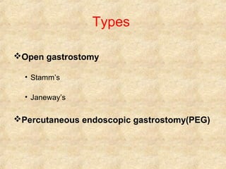 Gastrostomy | PPT