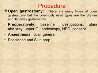 Janeway Gastrostomy Tube