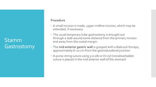 Gastrostomy feeding (temporary) | PPTX