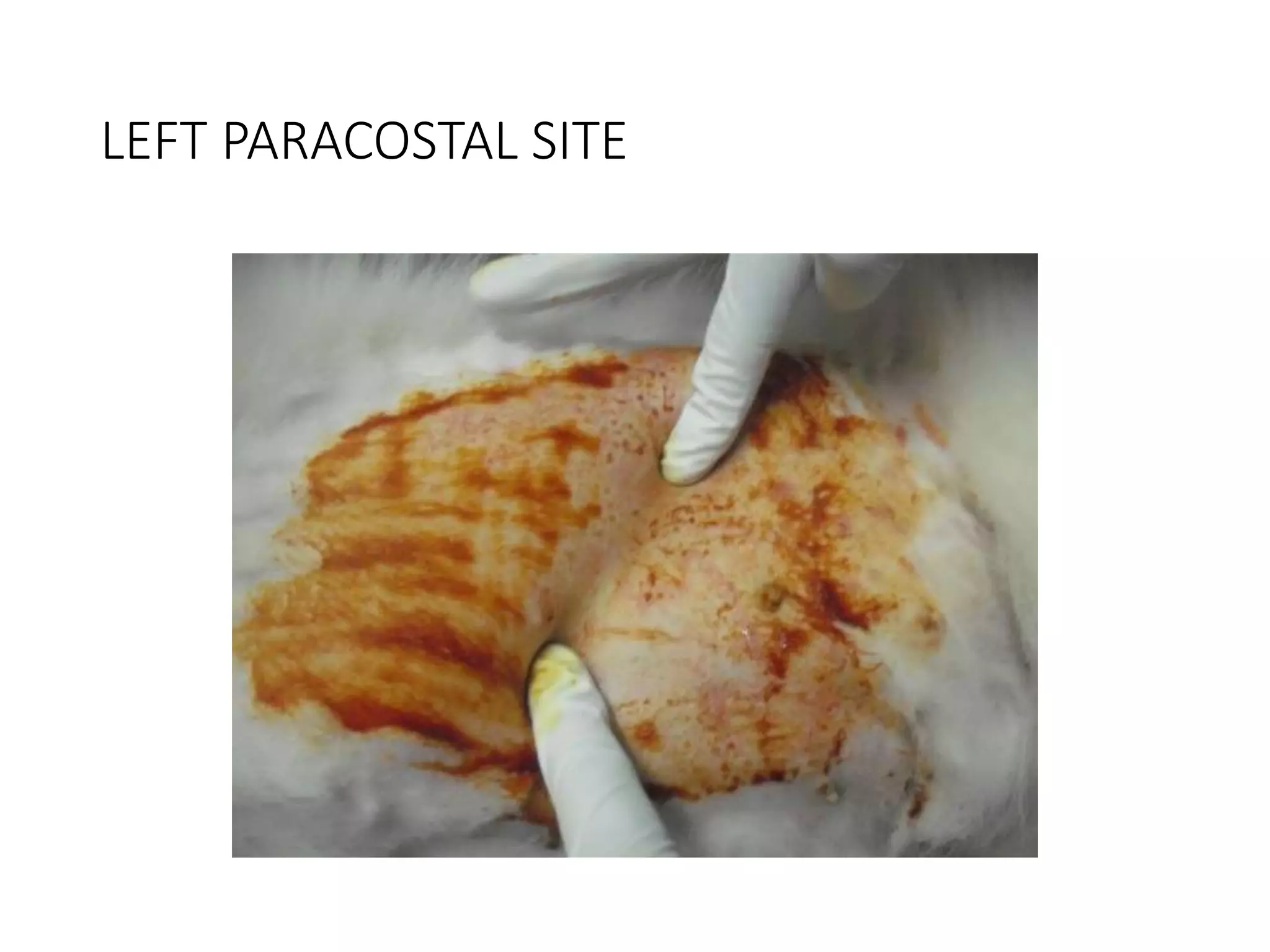 Surgical Extraction of Gastric Foreign Body | PPT