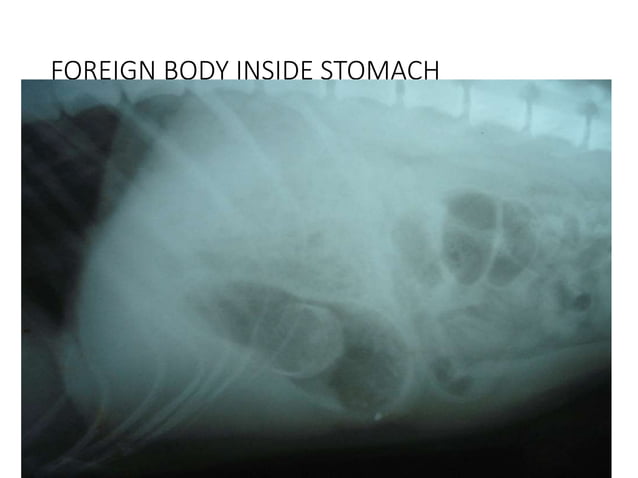 Surgical Extraction of Gastric Foreign Body | PPT