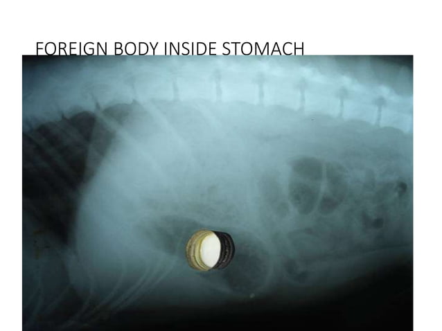 Surgical Extraction of Gastric Foreign Body | PPT