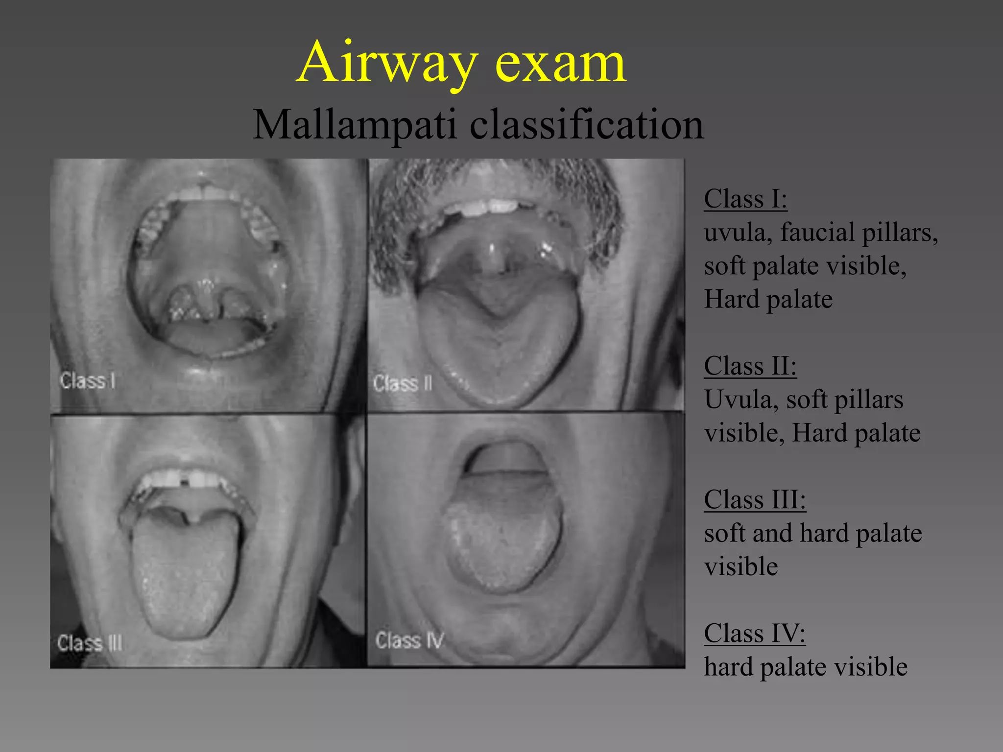 GENERAL ANESTHESIA TECHNIQUE.ppt