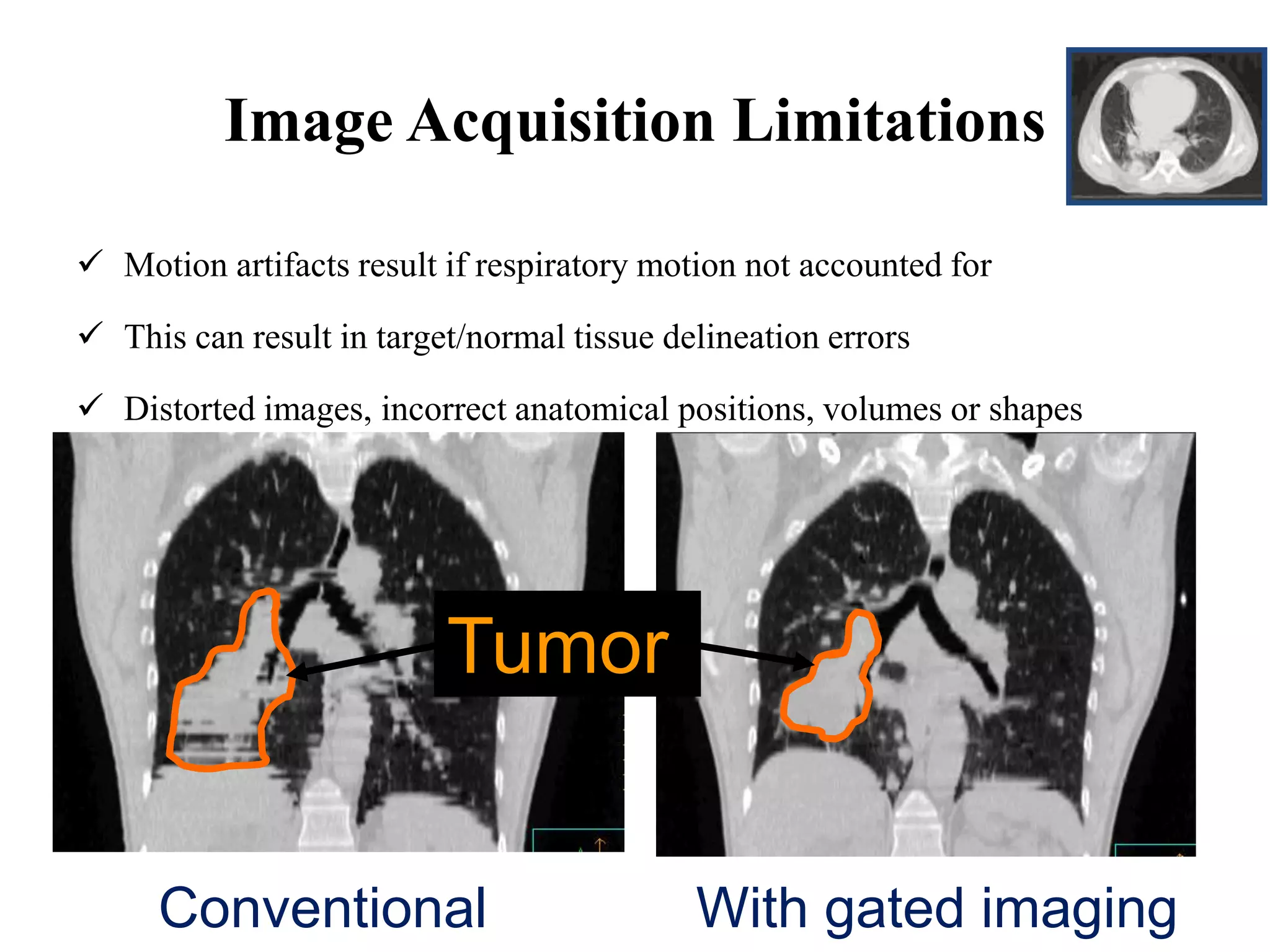 4D Scan and Respiratory Gating | PPTX