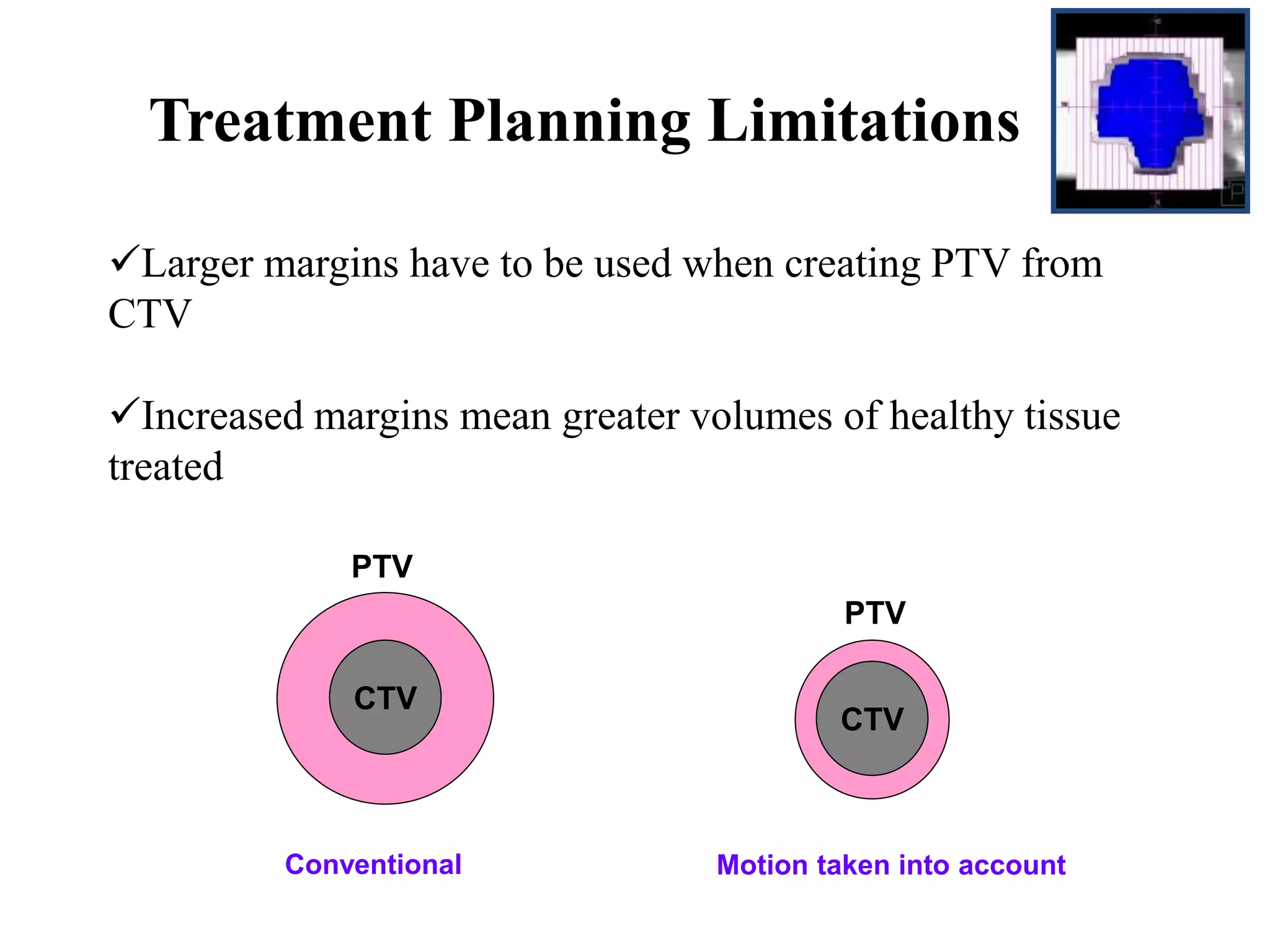 4D Scan and Respiratory Gating | PPTX
