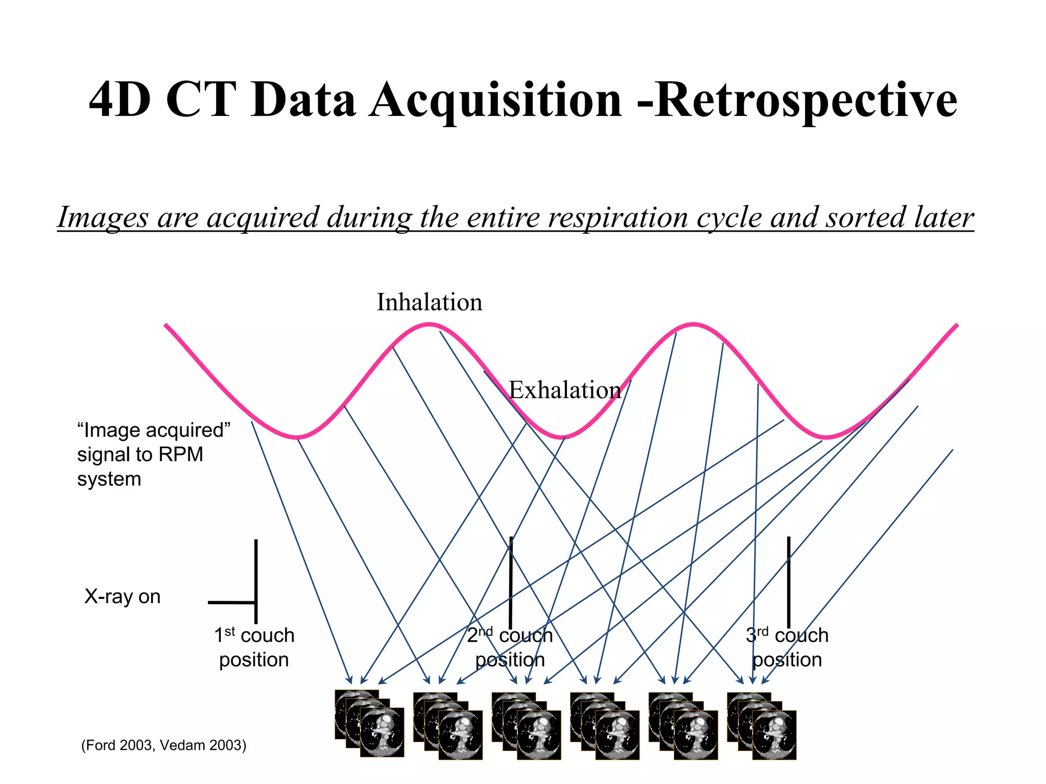 4D Scan and Respiratory Gating | PPTX