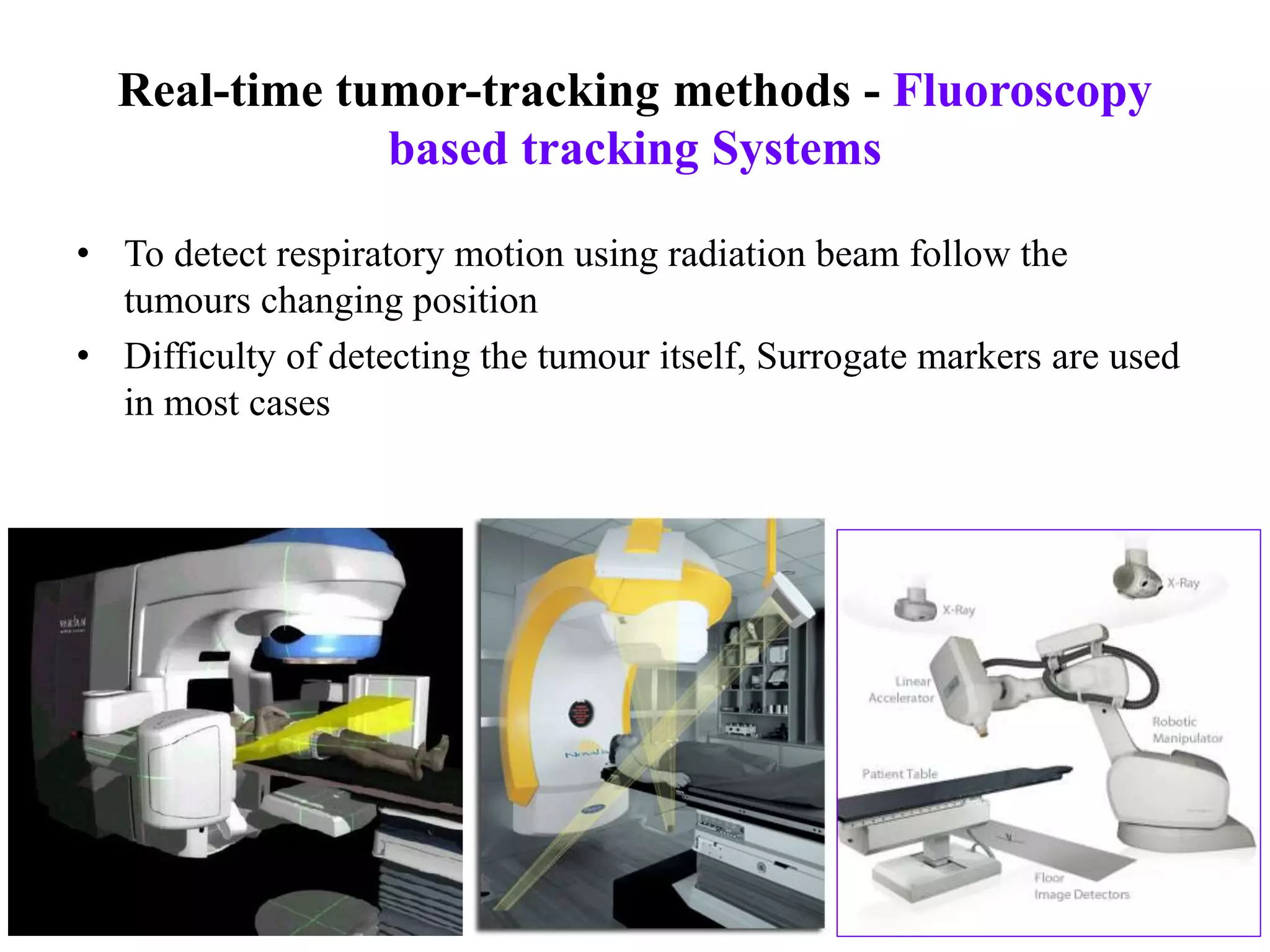 4D Scan and Respiratory Gating | PPTX