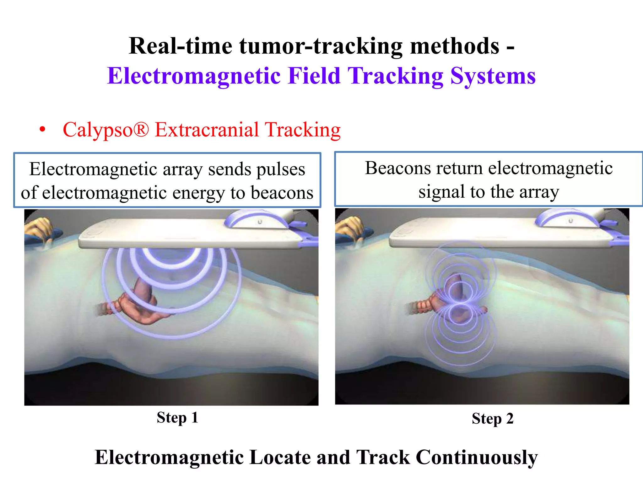 4D Scan and Respiratory Gating | PPTX