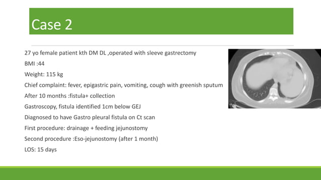 Gastro-Bronchial Fistula post Sleeve Gastrectomy | PPT