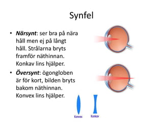öGat & synen p.p | PPTX | Eye and Vision Conditions | Diseases and ...