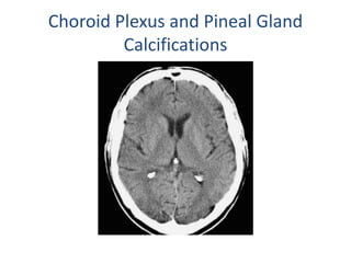 How to read a Head CT, CT Brain | PPTX