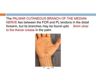 Carpal Tunnel Syndrome | PPTX