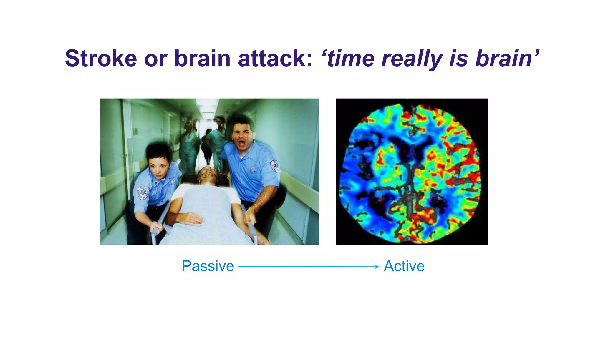 Gavin Giovannoni - Brain health: why time matters in MS | PPTX