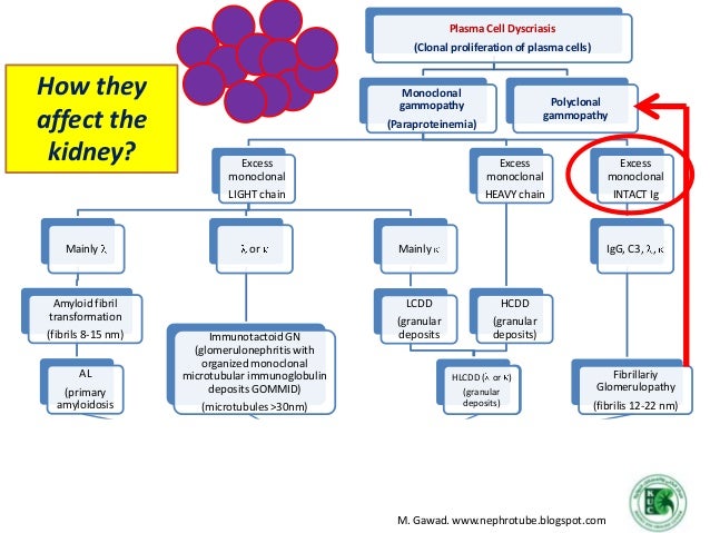 Plasma Cell Dyscrasias & The Kidney (How they affect the kidney? When ...
