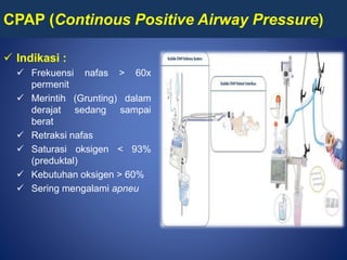 Gawat napas-pada-neonatus | PPTX
