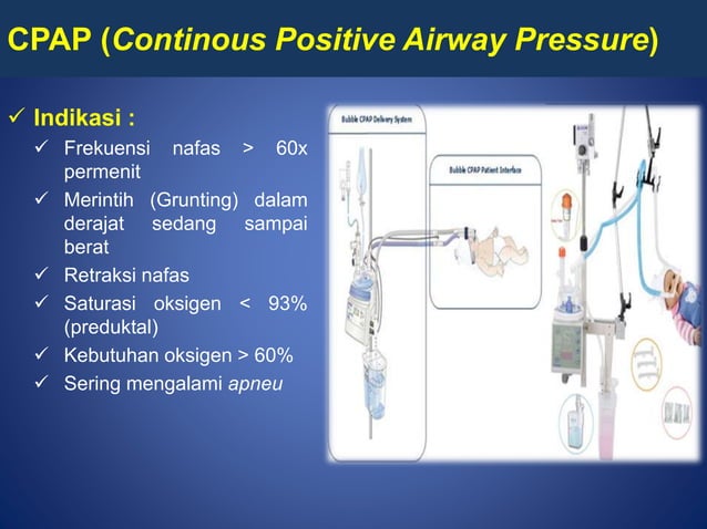 Gawat napas-pada-neonatus | PPTX