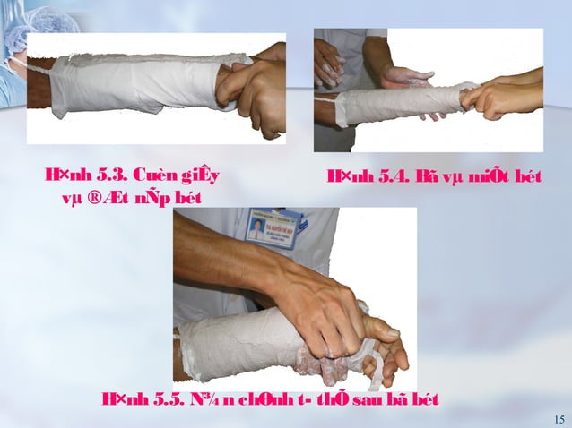 Gay pouteau colles | PPT