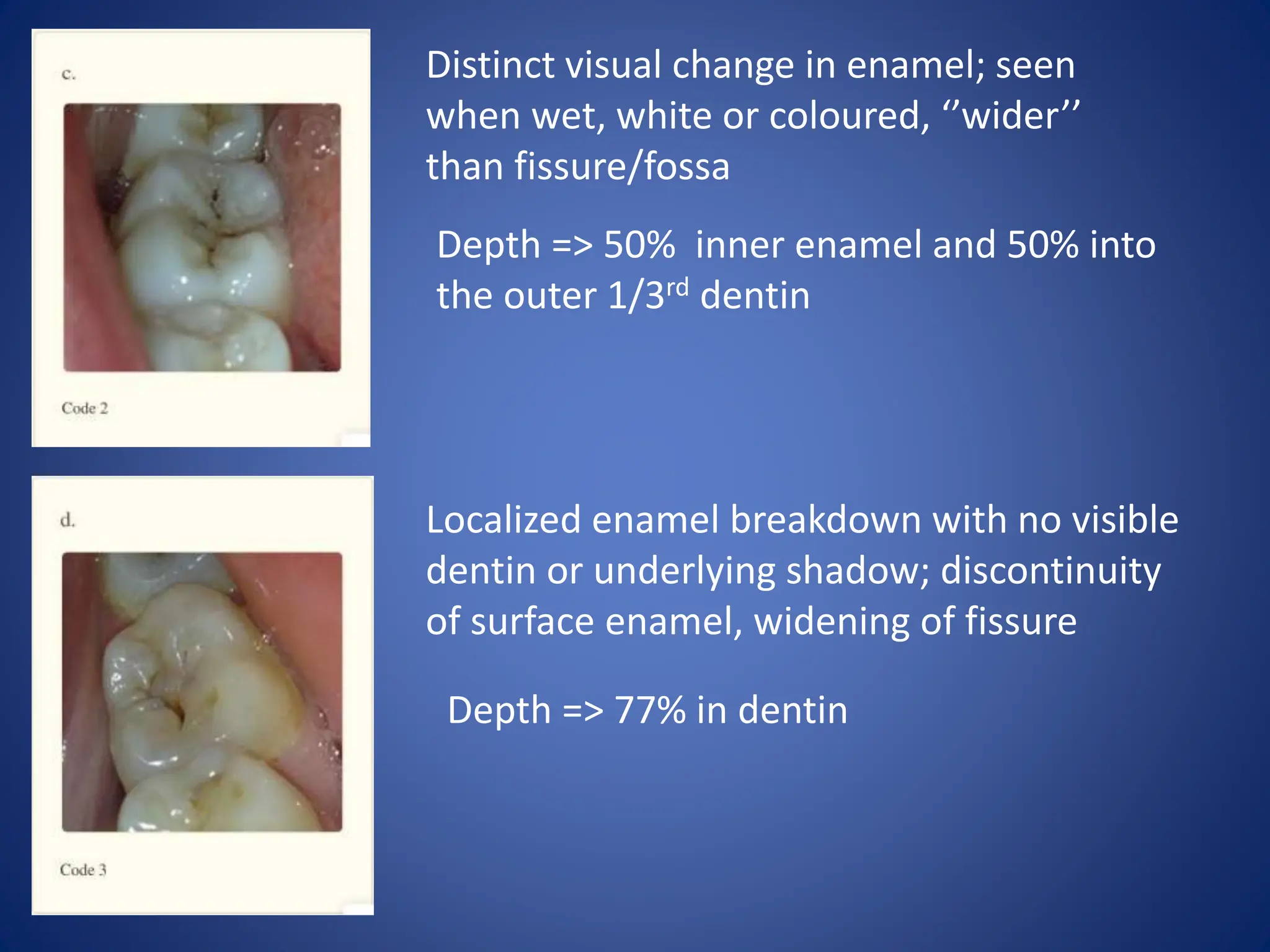 Primary caries secondary caries tertiary caries | PPTX