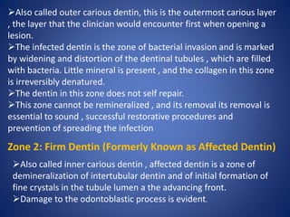 Primary caries secondary caries tertiary caries | PPT