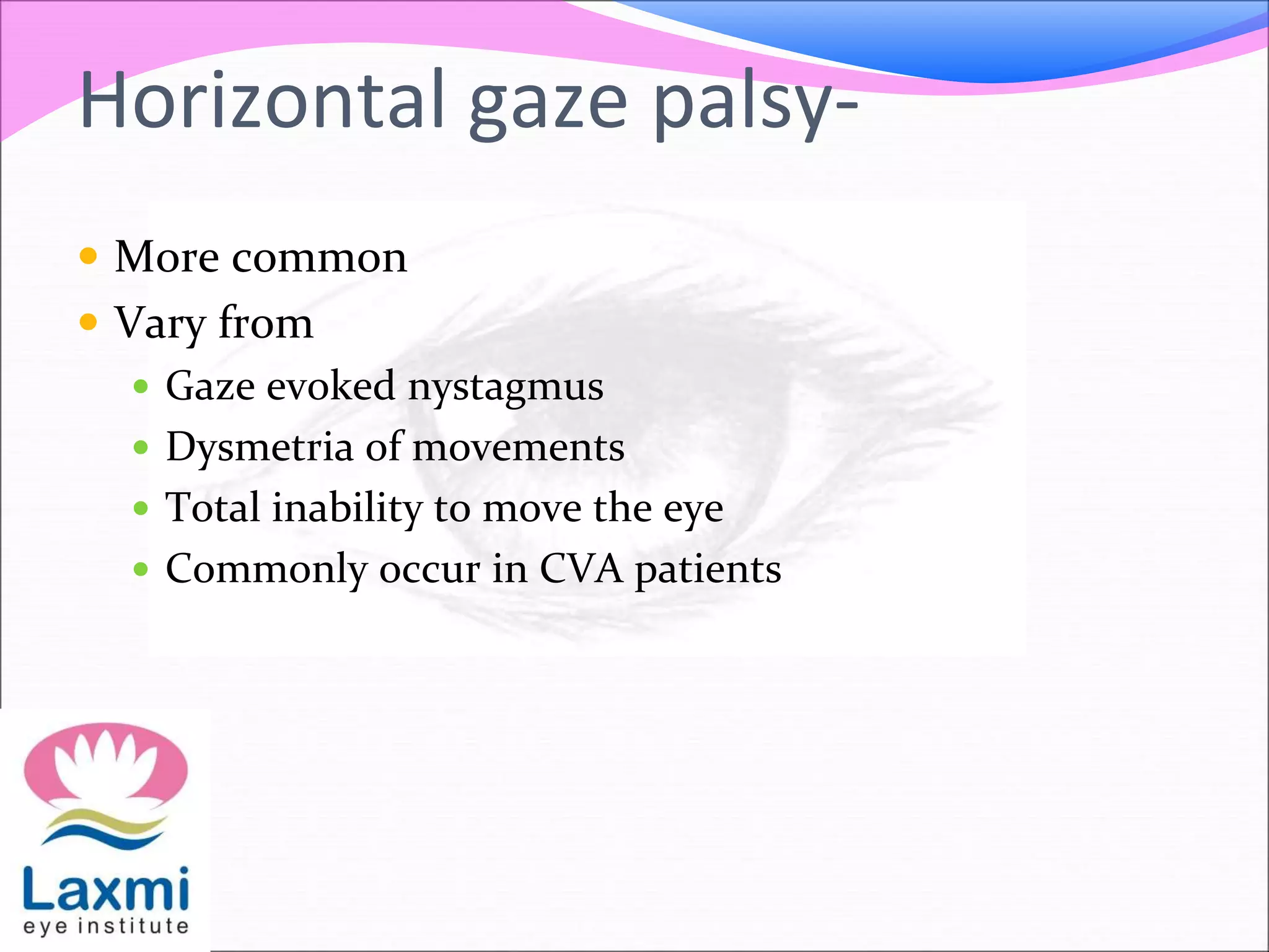 Gaze palsy | PPTX