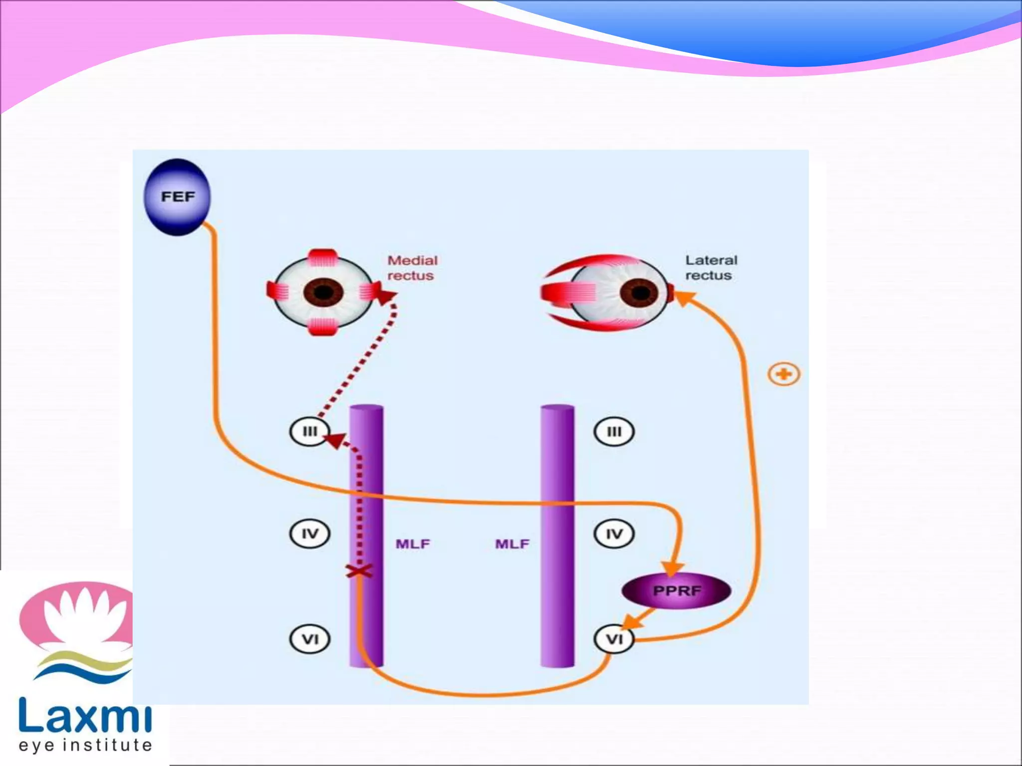 Gaze palsy | PPTX
