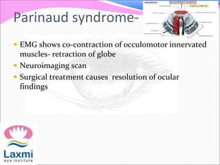 Parinaud Syndrome
