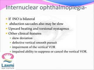 Internuclear Ophthalmoplegia