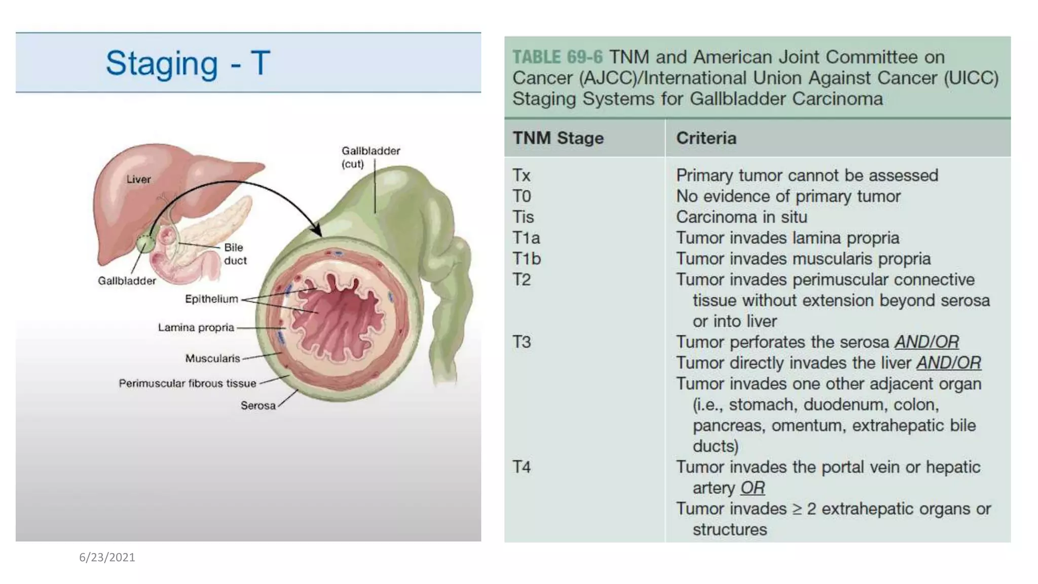 GALLBLADDER CARCINOMA | PPTX