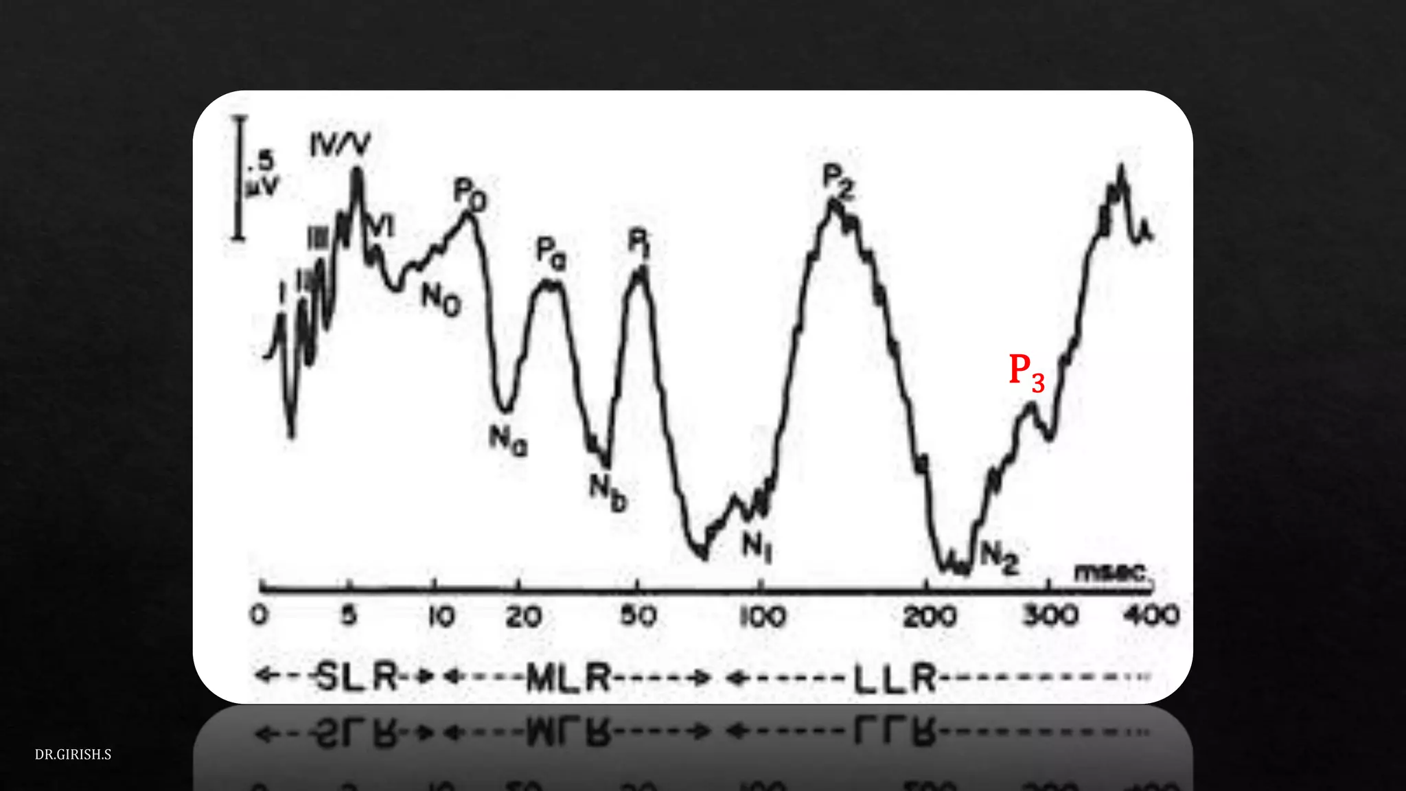BRAINSTEM EVOKED RESPONSE AUDIOMETRY (BERA), AUDIOTORY BRAINSTEM ...