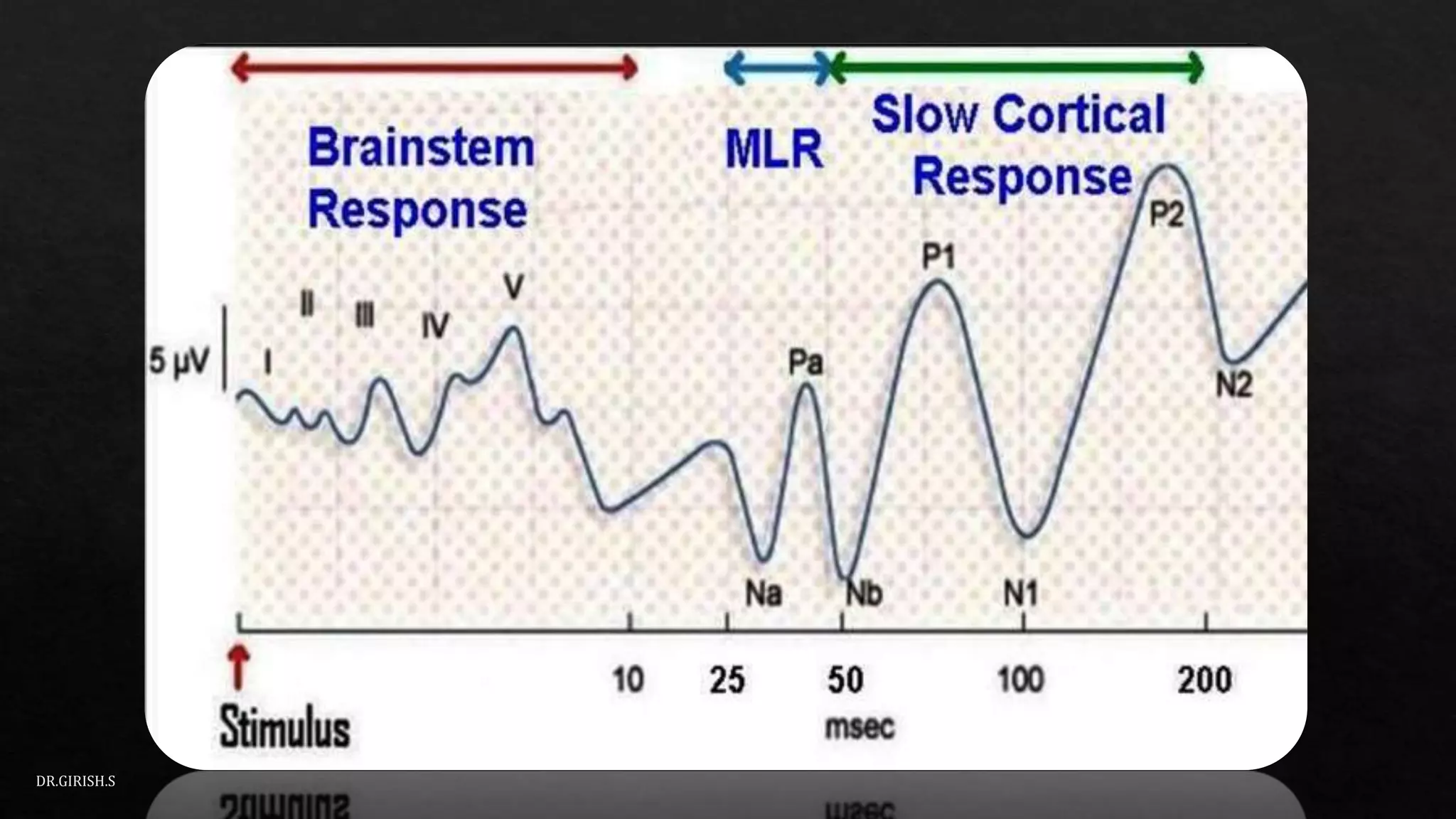 BRAINSTEM EVOKED RESPONSE AUDIOMETRY (BERA), AUDIOTORY BRAINSTEM ...