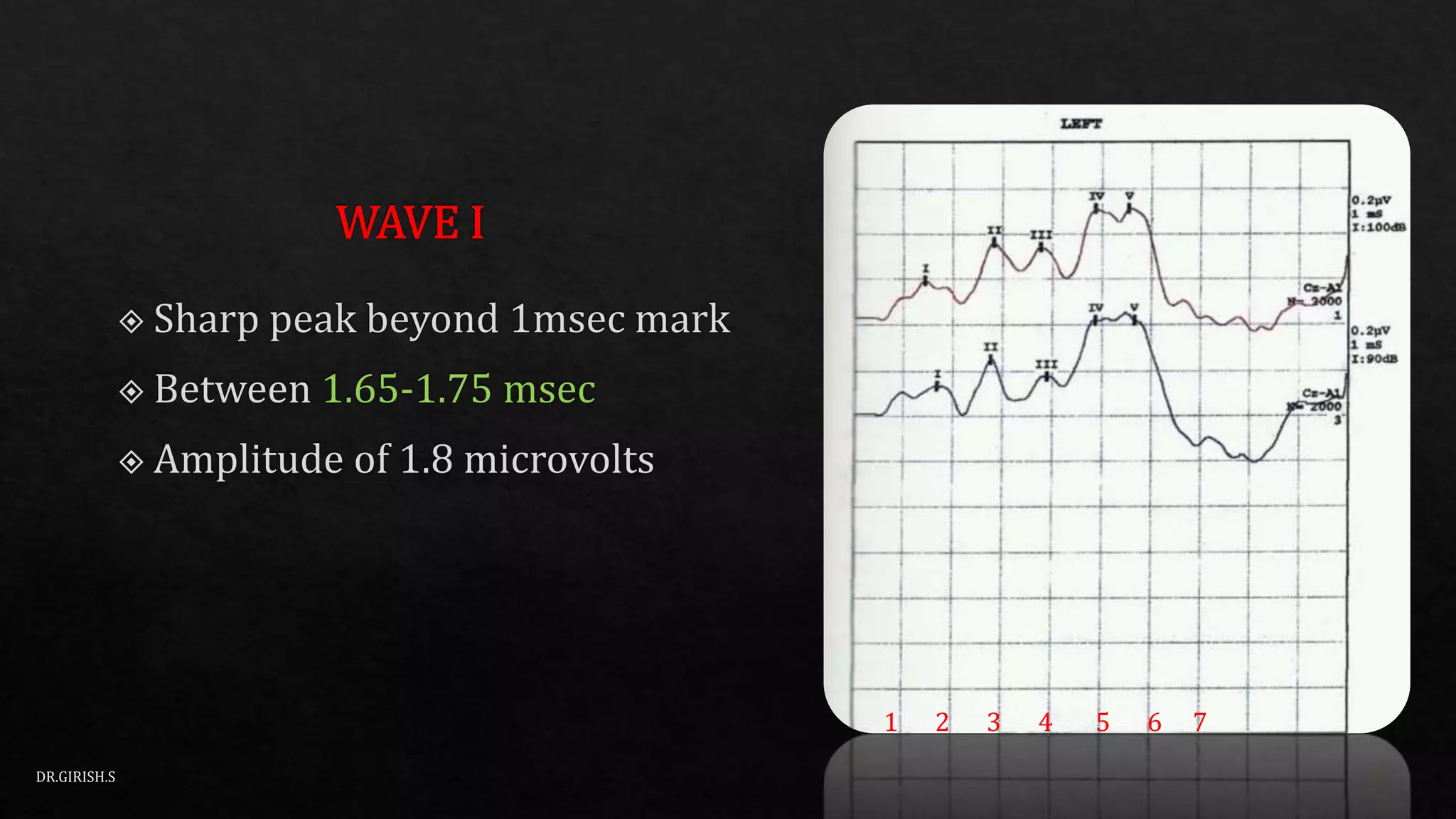 BRAINSTEM EVOKED RESPONSE AUDIOMETRY (BERA), AUDIOTORY BRAINSTEM ...