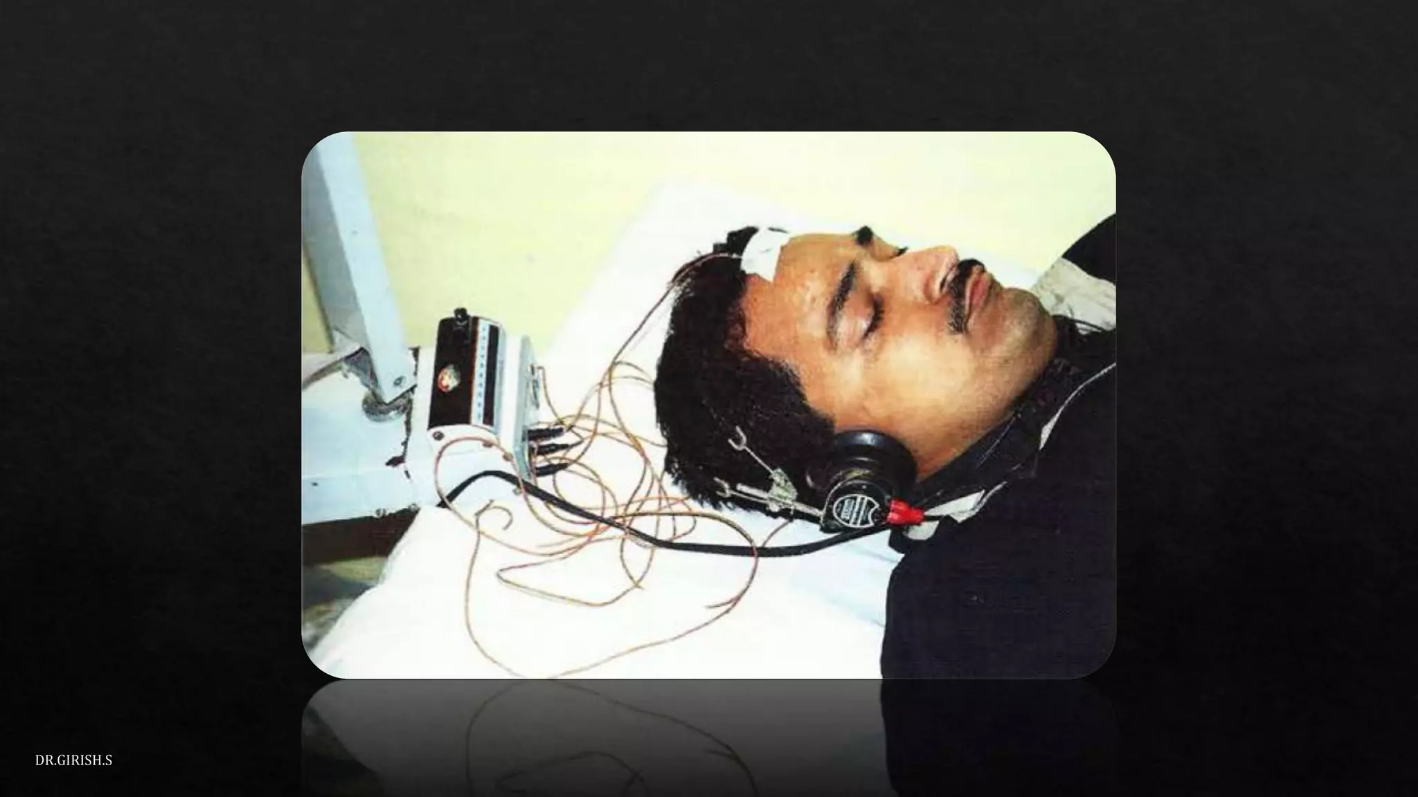 BRAINSTEM EVOKED RESPONSE AUDIOMETRY (BERA), AUDIOTORY BRAINSTEM ...