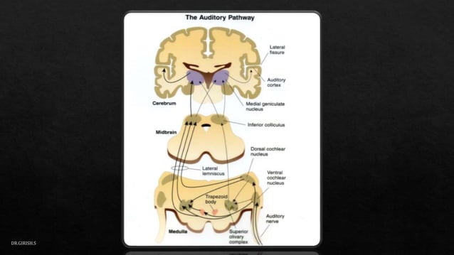 BRAINSTEM EVOKED RESPONSE AUDIOMETRY (BERA), AUDIOTORY BRAINSTEM ...