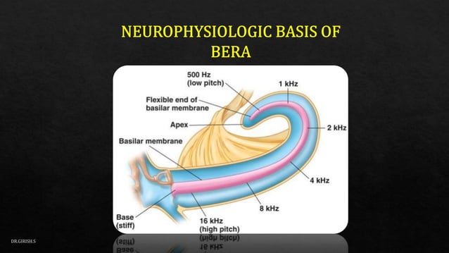 BRAINSTEM EVOKED RESPONSE AUDIOMETRY (BERA), AUDIOTORY BRAINSTEM ...