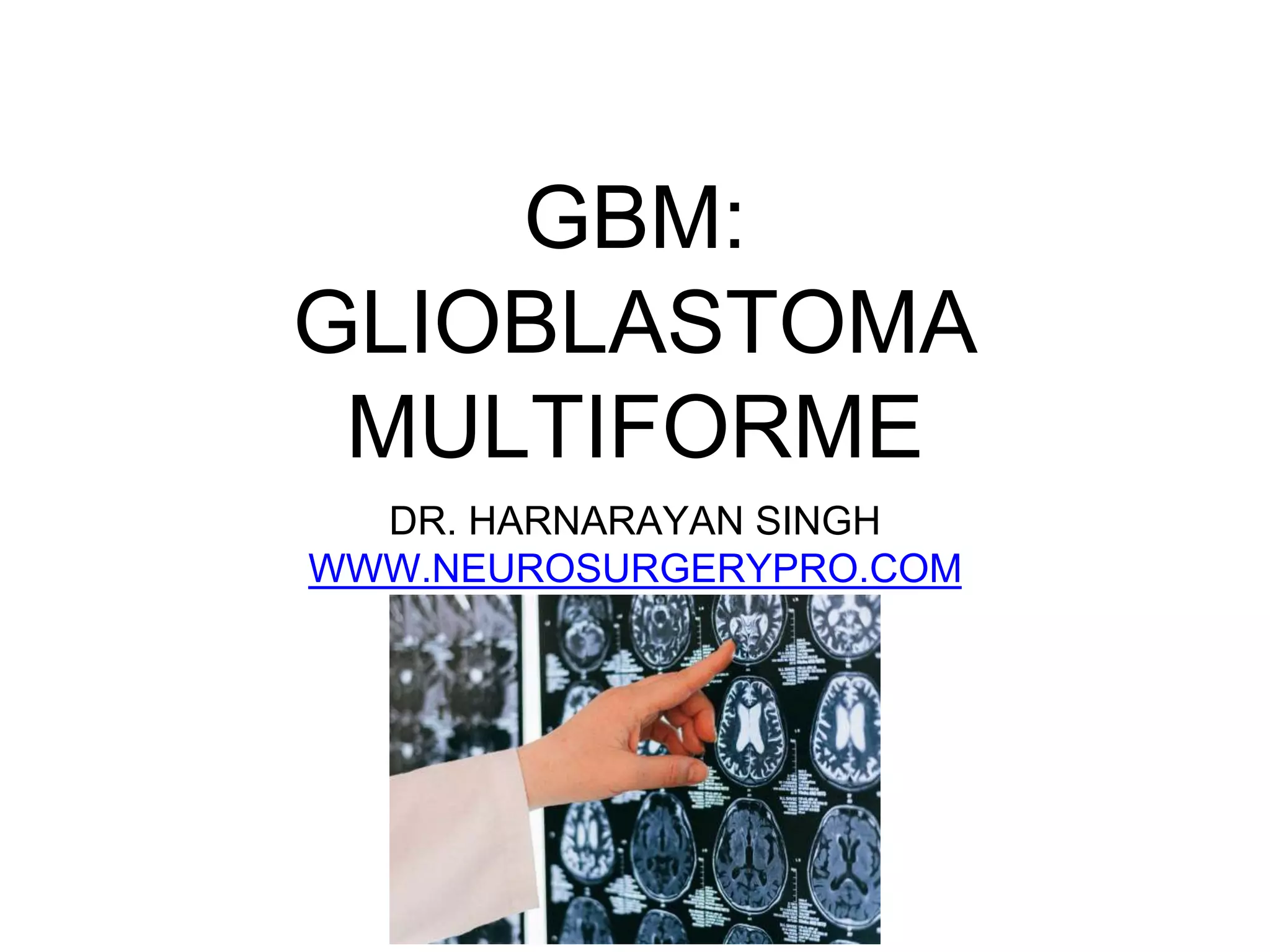 Gbm glioblastoma multiforme | PPTX
