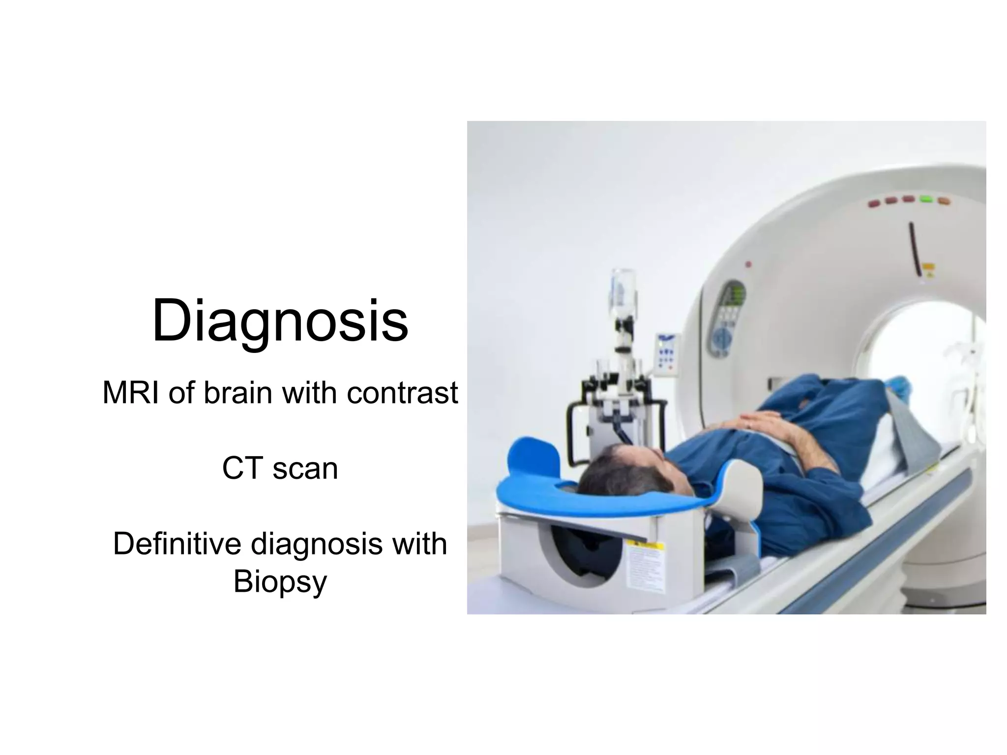 Gbm glioblastoma multiforme | PPTX