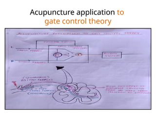 GB_Pain pathway & Modern theories of Acupuncture | PPTX