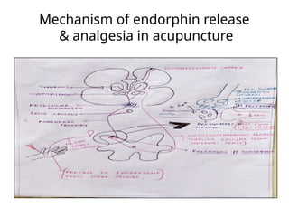 GB_Pain pathway & Modern theories of Acupuncture | PPTX