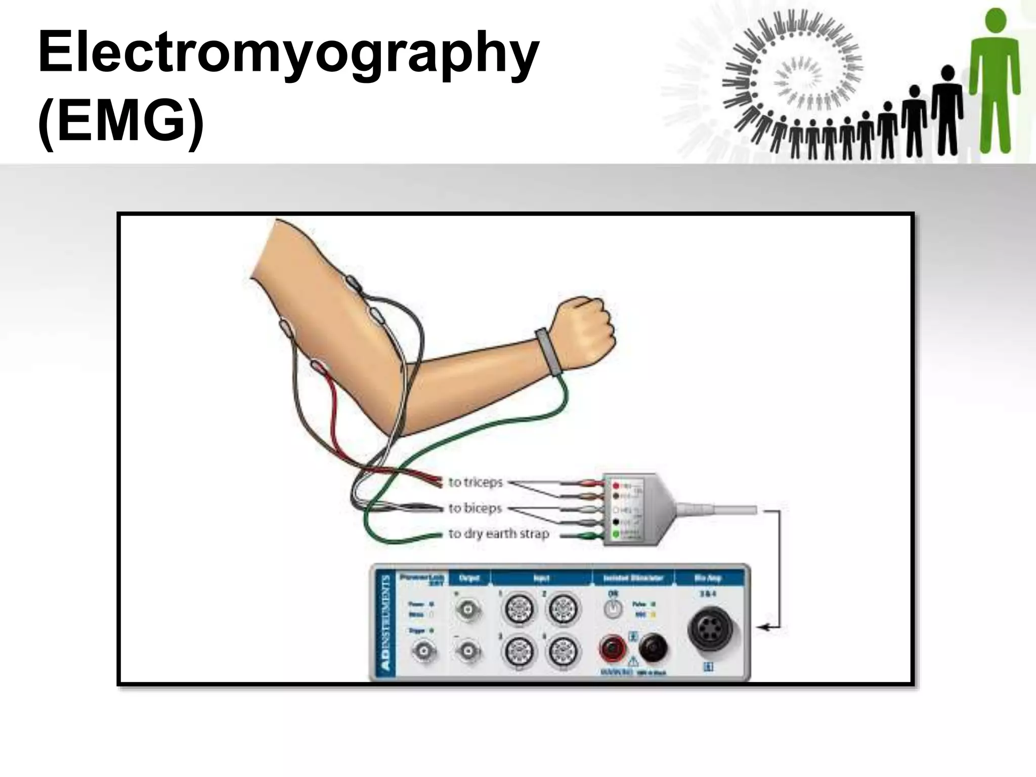 Guillain-Barré syndrome (GBS) | PPTX