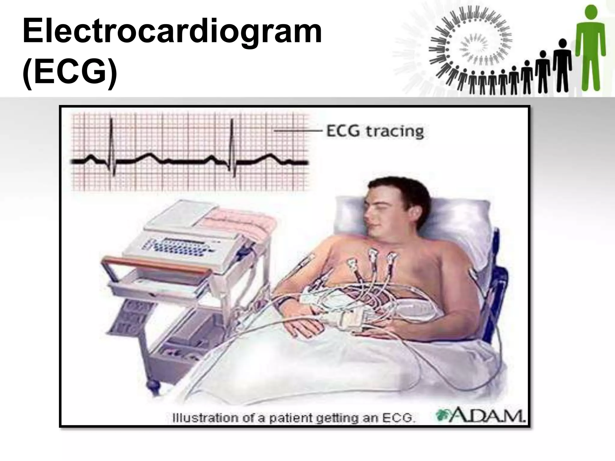 Guillain-Barré syndrome (GBS) | PPTX