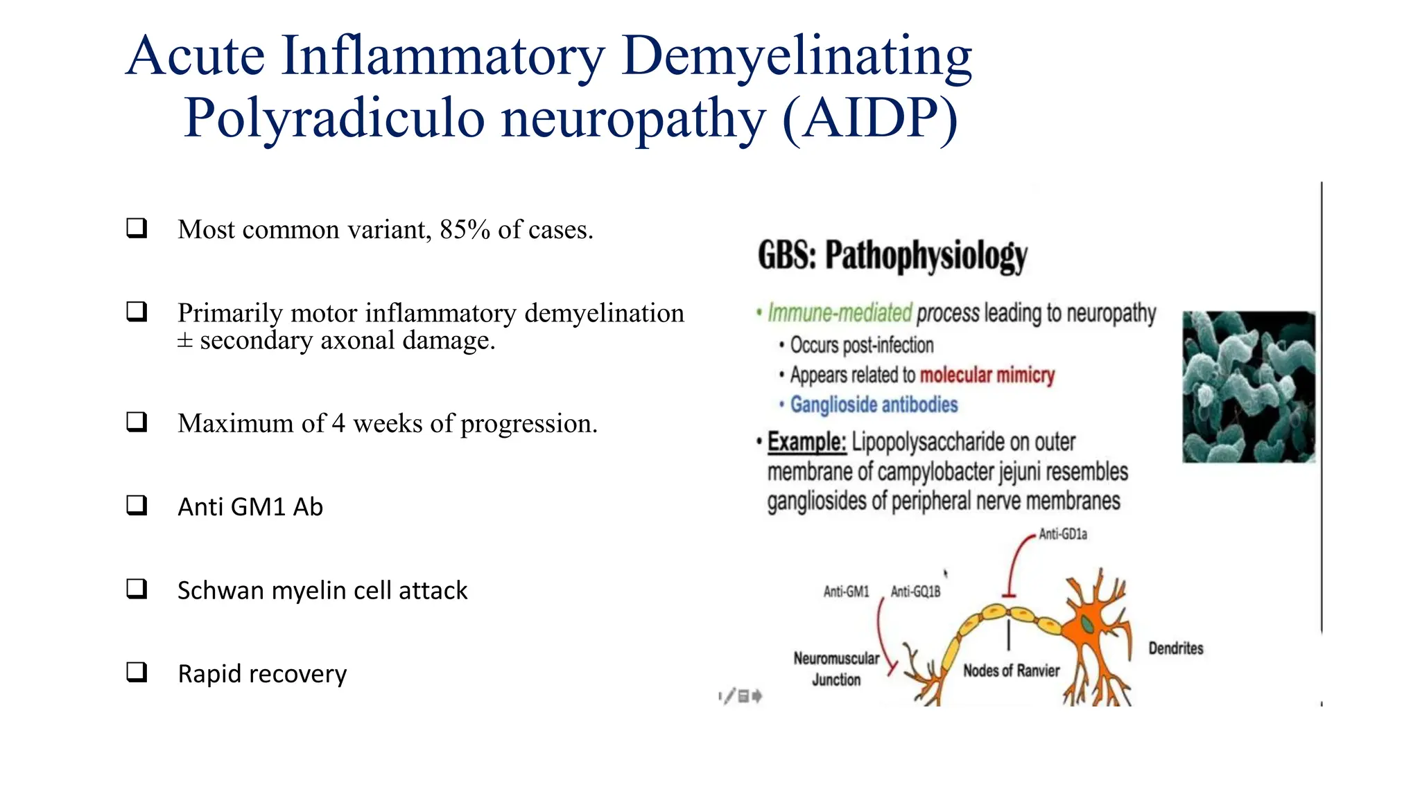 GBS Guillain-Barré syndrome (GBS) .pptx