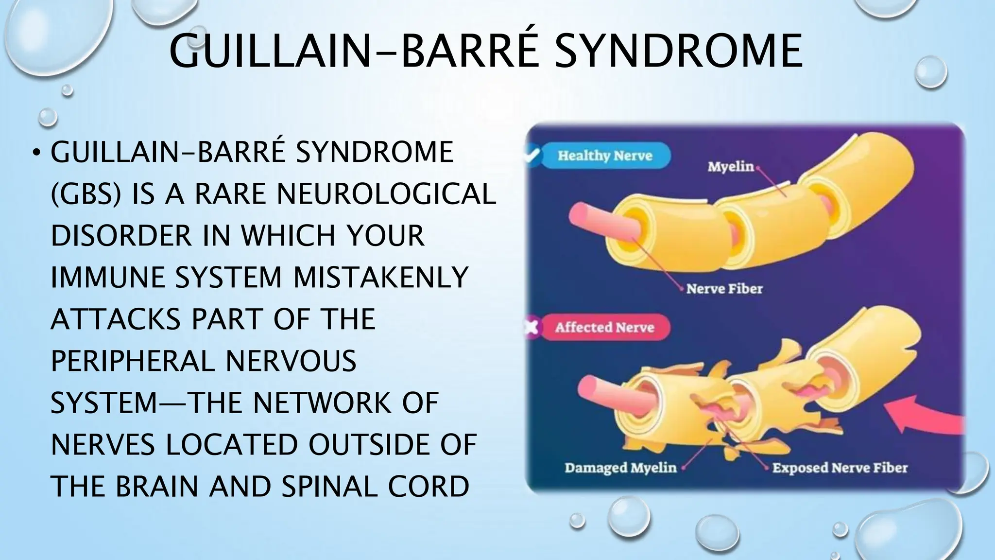 Guillain Barre syndrome (GBS) in brief PPT | PPTX