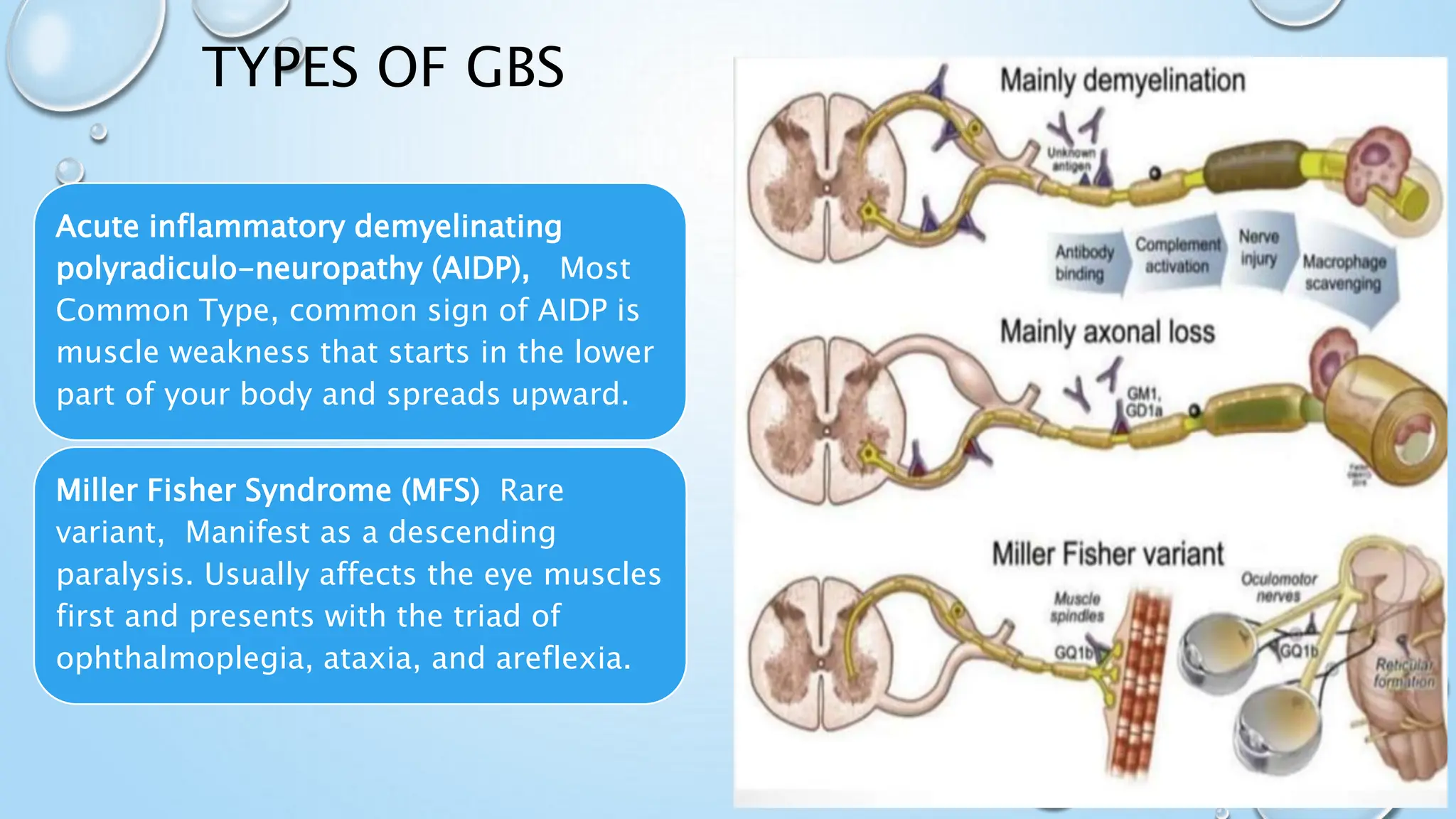 Guillain Barre syndrome (GBS) in brief PPT | PPTX