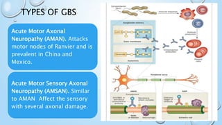Guillain Barre syndrome (GBS) in brief PPT | PPTX | Physical Therapy ...