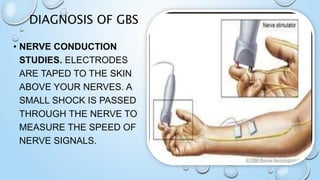 Guillain Barre syndrome (GBS) in brief PPT | PPTX