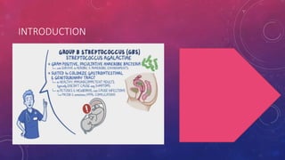 GBS in pregnancy - explaining the GBS.pptx