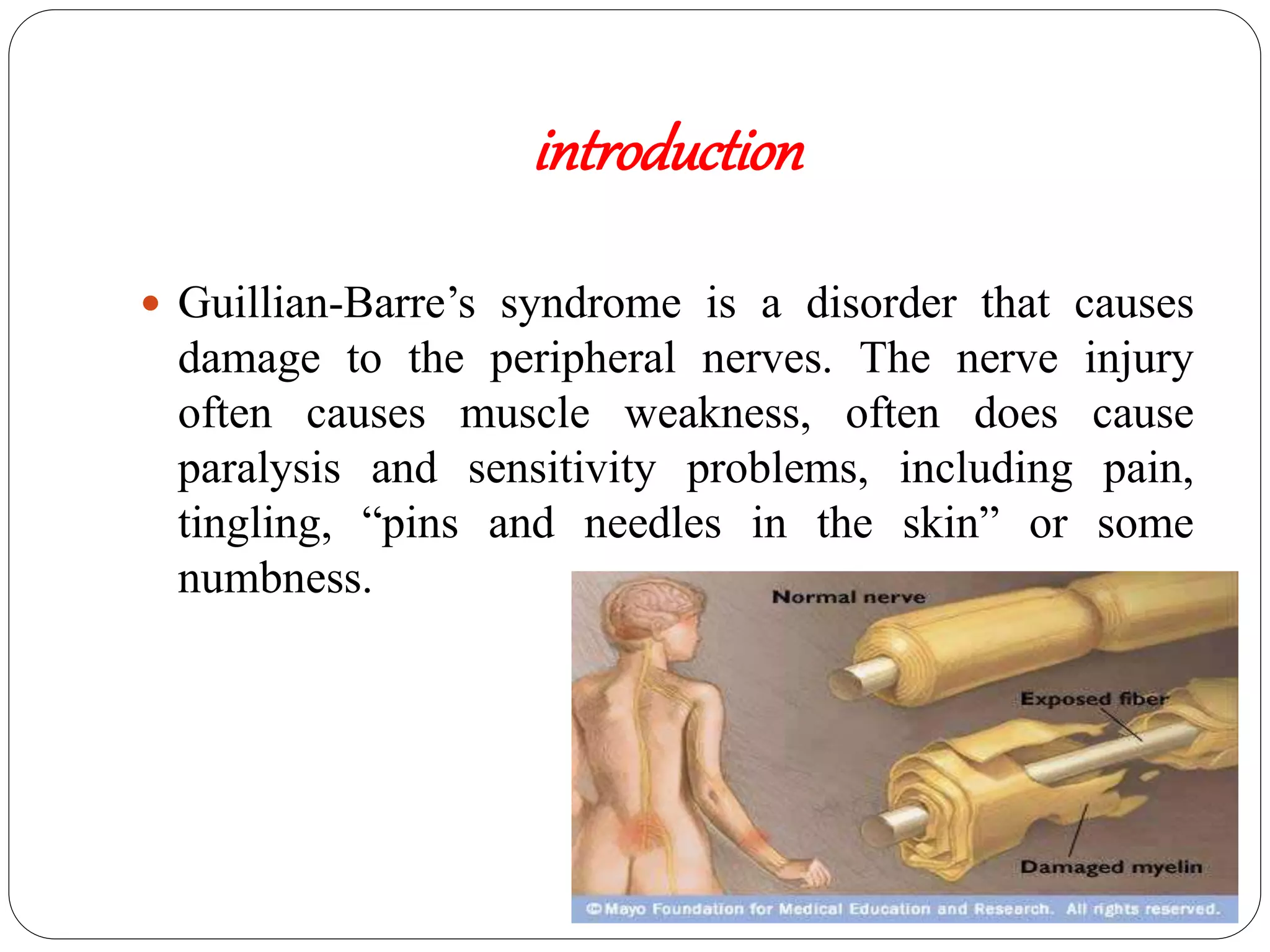 guillain barres' syndrome | PPTX
