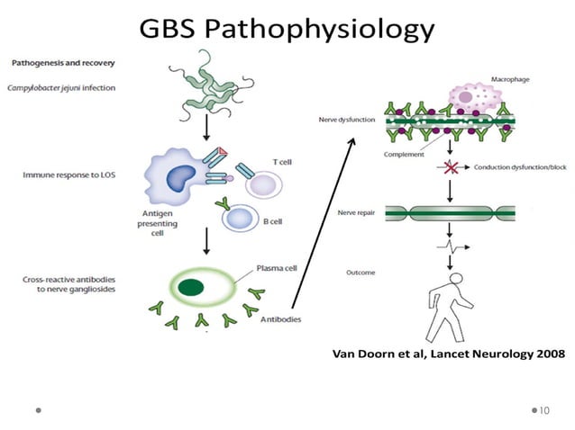 GB_Syndrome_revised in children Management.pptx