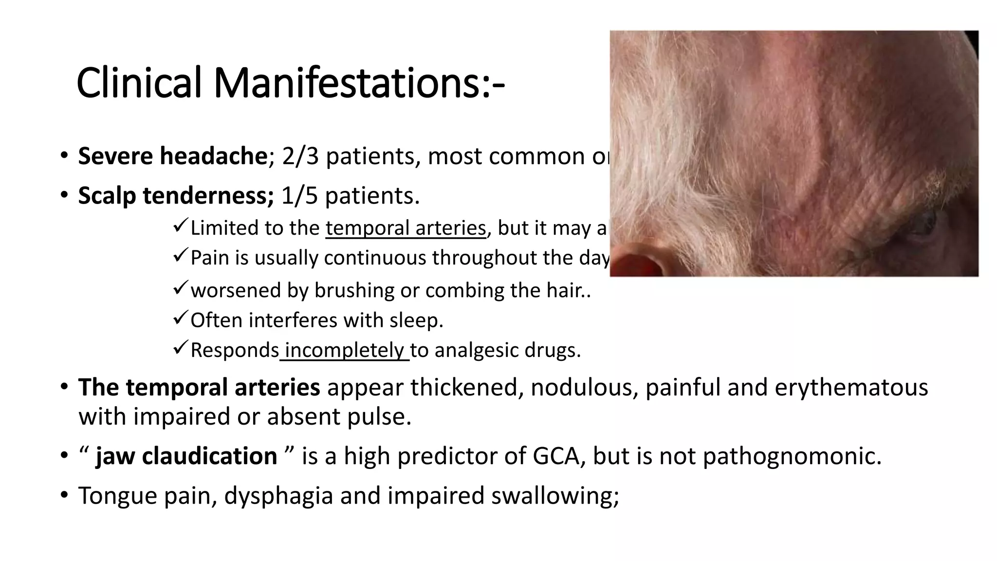 Gaint cell arteritiis (GCA) | PPTX