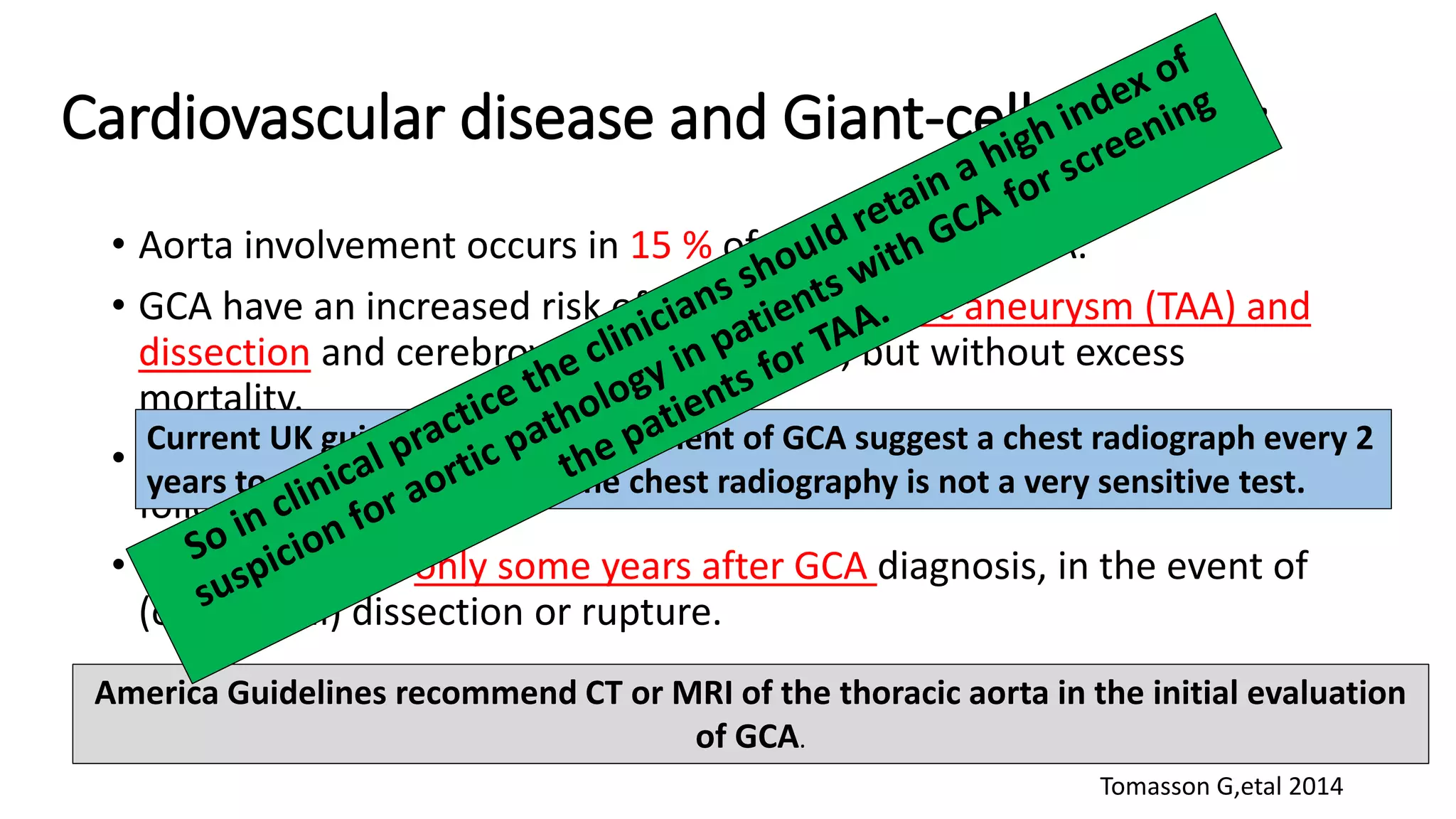 Gaint cell arteritiis (GCA) | PPTX
